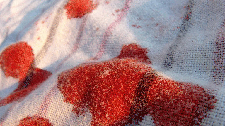 Cómo Quitar Manchas de Sangre •• (Guía Detallada) + Trucos
